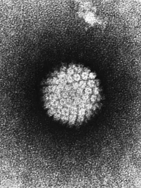 ľudský papilomavírus