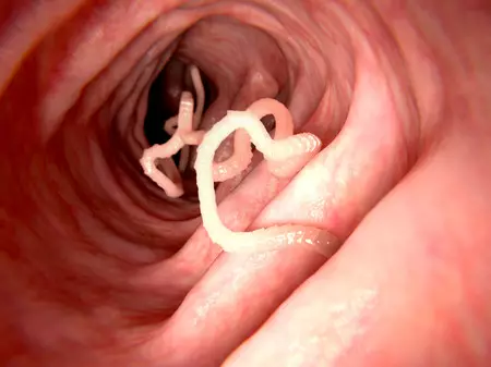 Ounjẹ Tapeworm