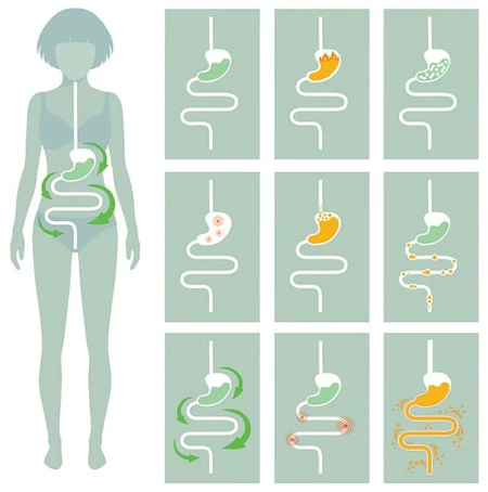 intestinal transitt