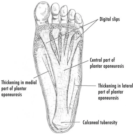 足底筋膜