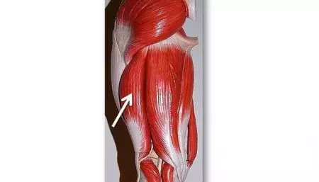 Anatomeg: Hamstrings, femoral? Na, Hamstrings