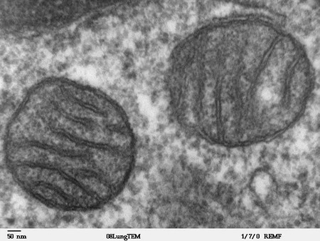 l-carnitina