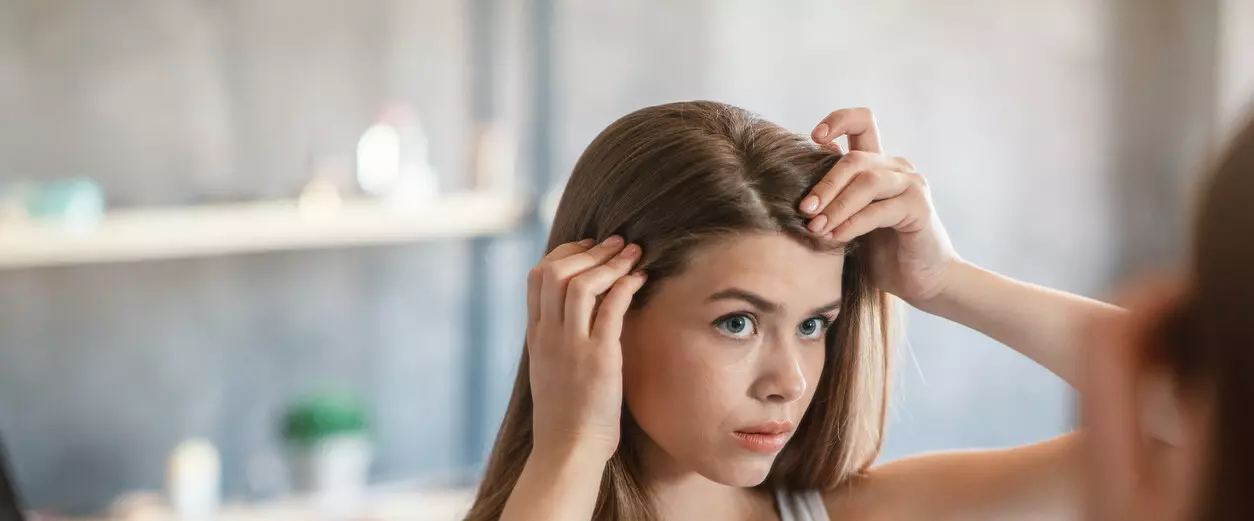 Dandruff kapa seborrheic dermatitis: u ka li khetholla joang le hore na phekolo ea nyeoe ka 'ngoe ke efe