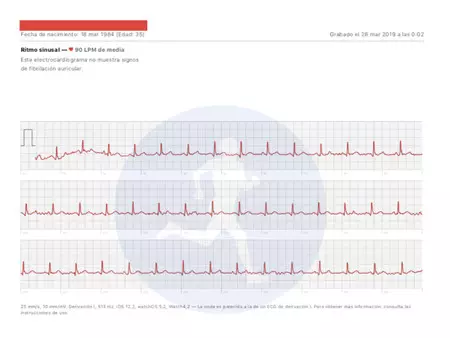 ekg-alma-saat