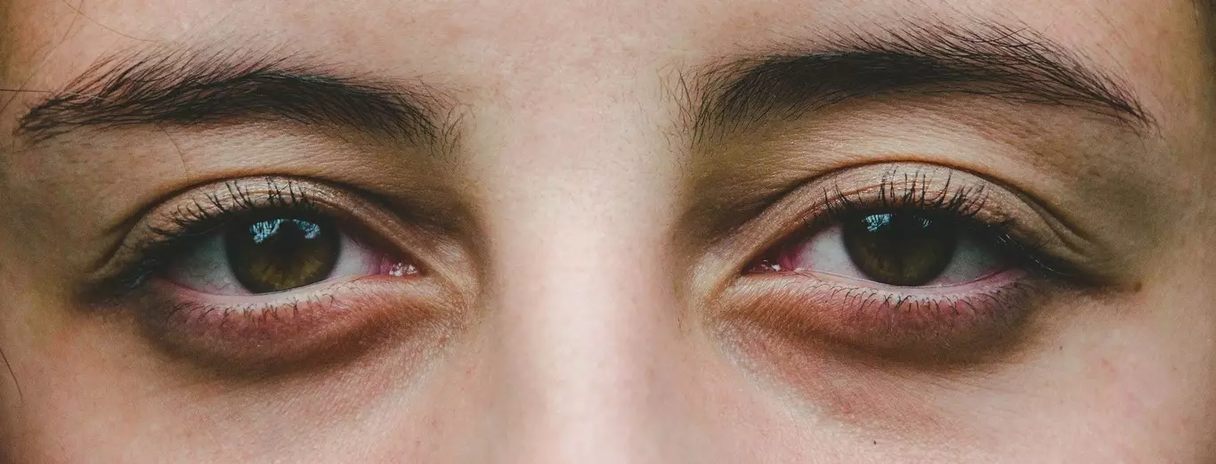 Siku ya Glaucoma Duniani: ni nini, jinsi inavyogunduliwa na jinsi ya kuizuia